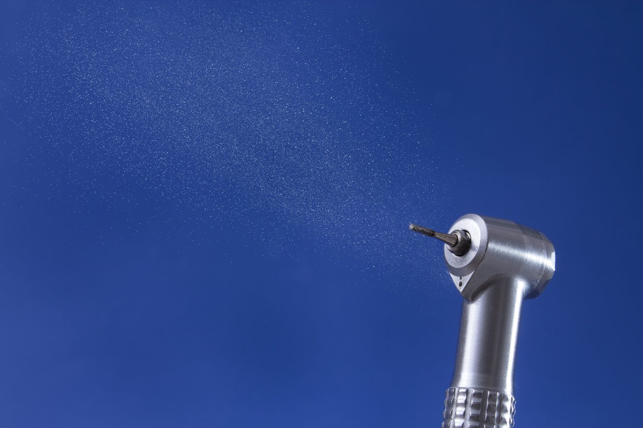 The Secret Life of Spatter (And How to Combat It)